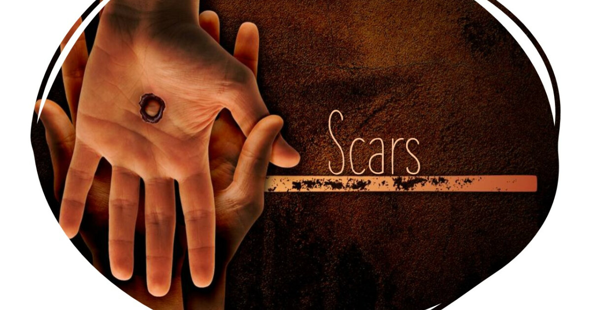 Scars | Sermons | The Point Christian Fellowship